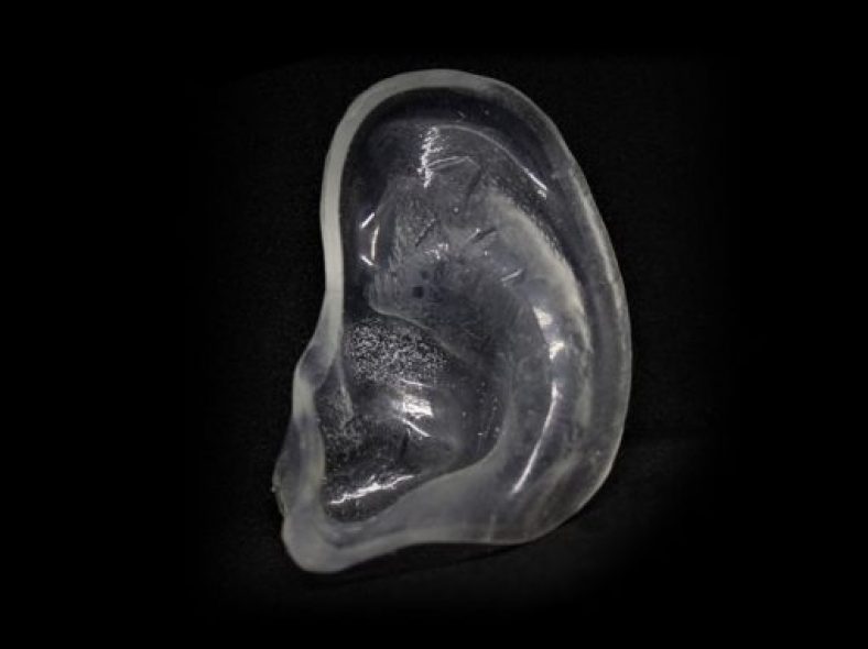 Mother of Rugby Player Invented Her Own Cauliflower Ears Protection ...