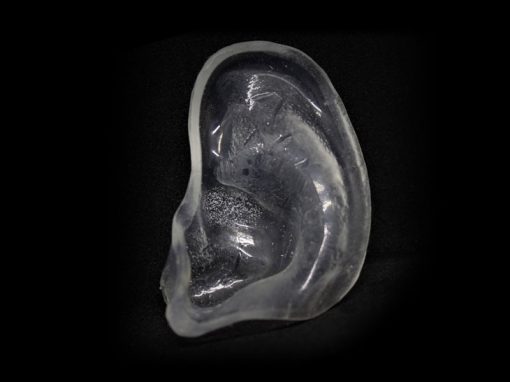 Mother of Rugby Player Invented Her Own Cauliflower Ears Protection ...